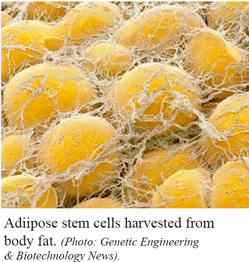 Adipose Stem Cells W Cutline Global Stem Cells Group