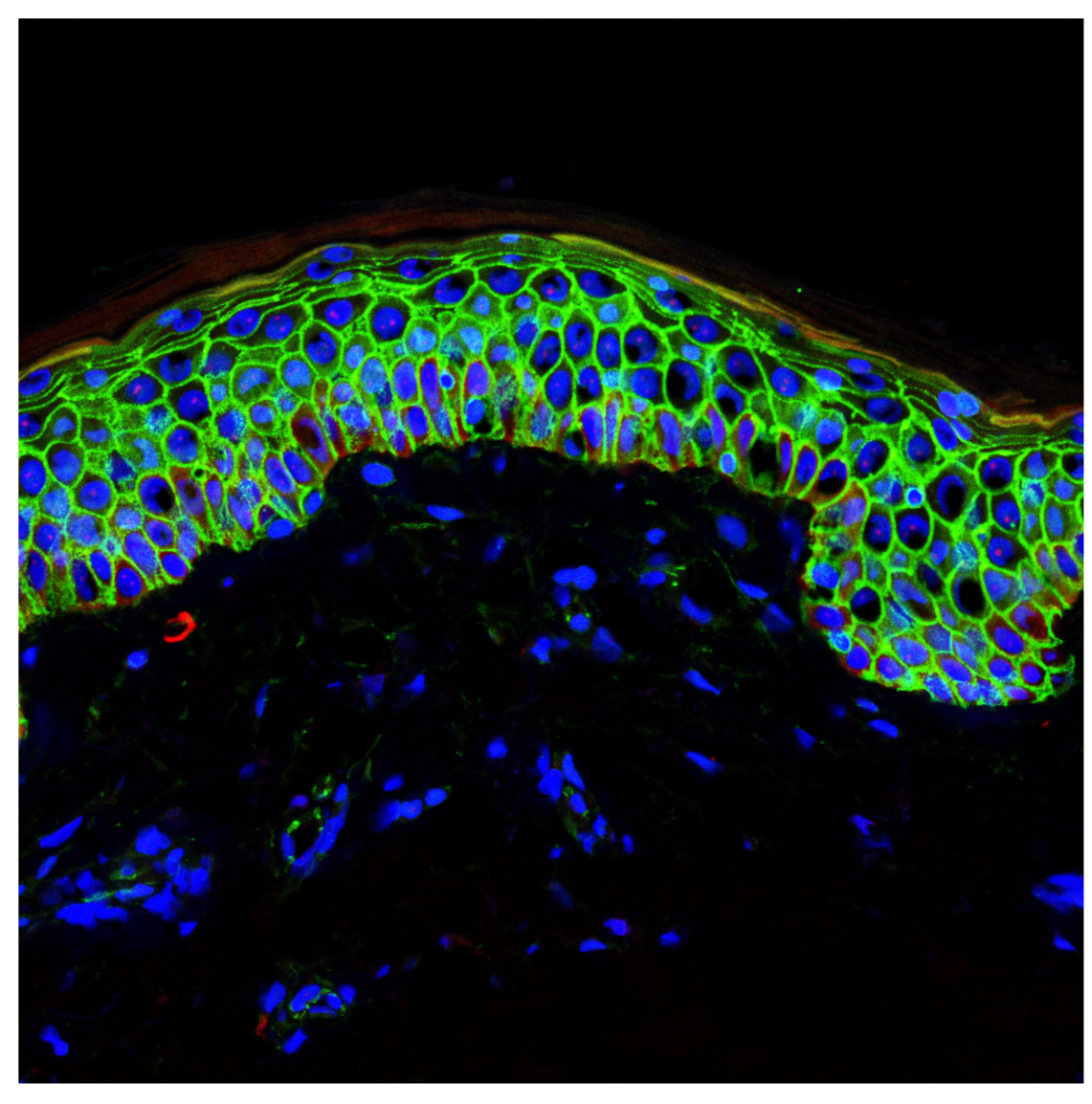 Skin Stem cell research breakthroughs you may never have heard of